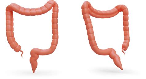 Clipart Terminal Ileum
