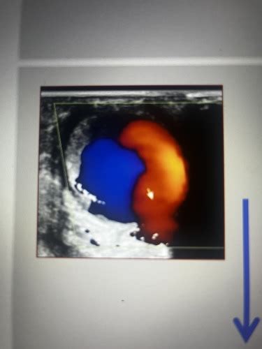 Test 1 Flashcards Quizlet