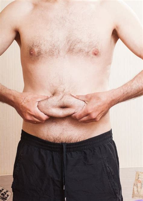 Men Obesity Stock Image Image Of Belly Bare Disease