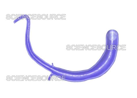 Mitral Valve Annuloplasty Artwork Stock Image Science Source Images