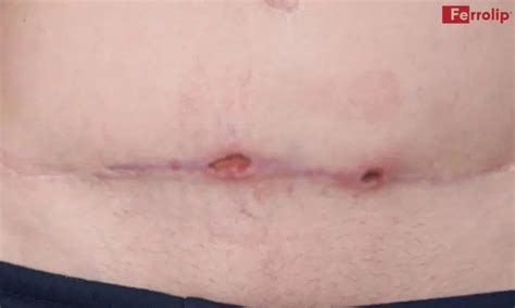 H Nh Nh V T M Sau Sinh C Ch Ch M S C V T M Nhanh L Nh