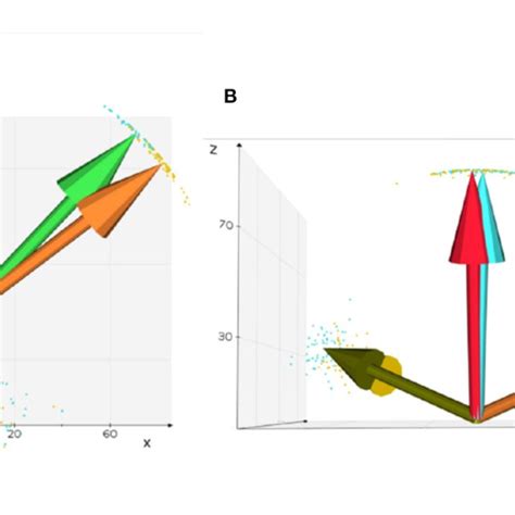 Calculate The Angle Between The Plane Of The Semicircular Canal And The