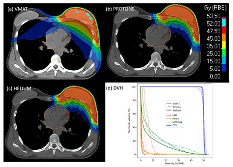 Development Of Deep Learning Chest X Ray Model For Cardiac Dose