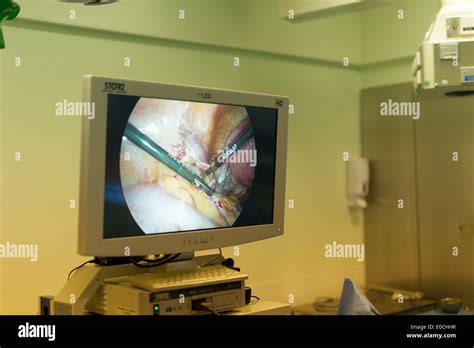 Gynaecological Examination Stock Photos Gynaecological Examination Stock Images Alamy