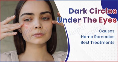 Dark Circles Under The Eyes Causes And Treatments