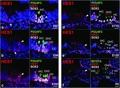 Expression Pattern Of Hes In The Developing Cochlea Of Primates A In