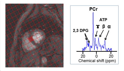 31 P Mrs Spectrum Acquisition An Example Of The Voxel Positioning Download Scientific