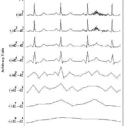 A Normal ECG Signal And Frequency Distribution The Frequency Response Download Scientific