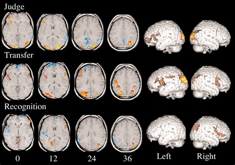 Brain Activations Across The Three Conditions Left Panel Averaged