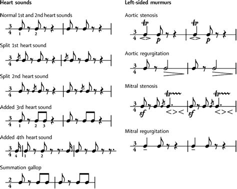 Help Musical Notation For Heartbeat R Musictheory