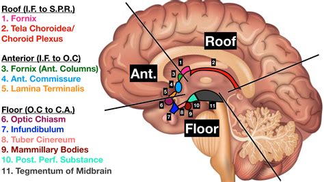 Ventricular System Labeled