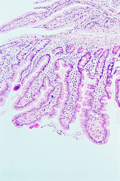 520 Jejuno Fotos Fotos De Stock Imagens E Fotos Royalty Free Istock