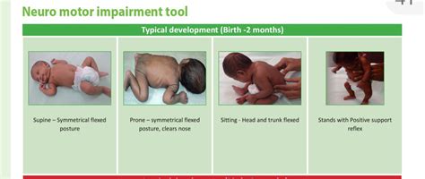 Positive Support Reflex