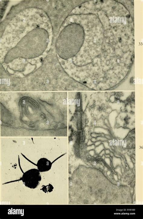 Electron Microscopic Structure Of Protozoa 1963 Electron Microscopic Structure Of Protozoa