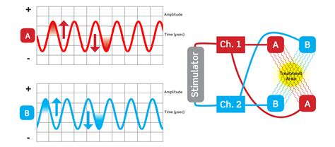 How To Compare Tens Units By Signal Type — Rs Medical
