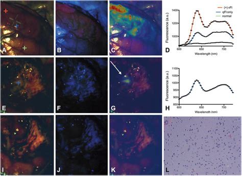 Spectrally Resolved Quantitative Fluorescence Imaging Using A Download Scientific Diagram