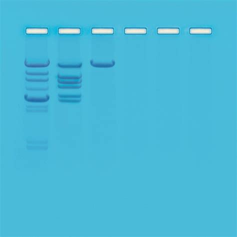 Cleavage Of Lambda Dna With Eco Ri Restriction Enzyme Stem