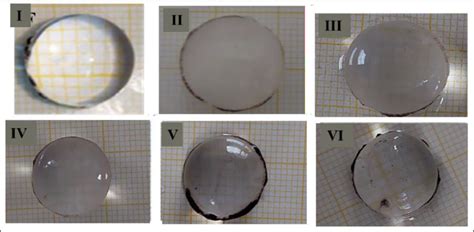 Photograph Images Depicting The Reduced Cataract Opacity After The
