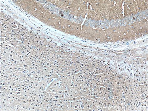 Alpha Synuclein Antibody 10842 1 Ap Proteintech