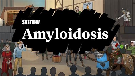 Understanding Amyloidosis Part 1 Sketchy Medical Usmle Step 1 Youtube