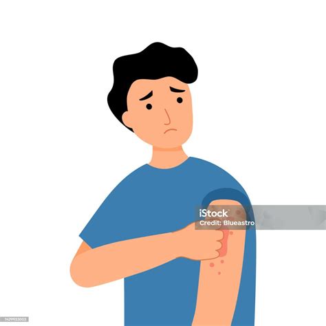 젊은 남자 긁힘 팔 평평한 디자인에서 강한 알레르기 피부 가려운 증상으로 고통받는 남자 붉은 발진 피부 자극 모기에 대한 스톡 벡터 아트 및 기타 이미지 Istock