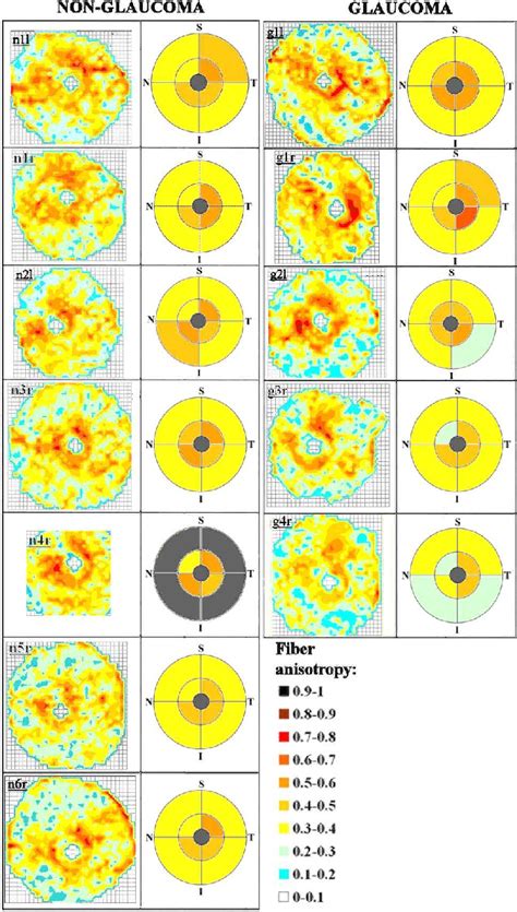 Fiber Anisotropy Across Posterior Sclera Left Panel Contour Maps Of