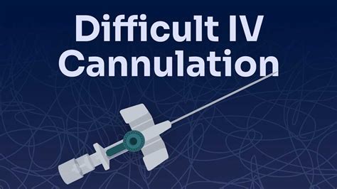 Managing Difficult Iv Cannulation Ausmed