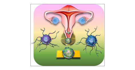 An Innovative 3d Ide Design And Adaptive Signal Extraction Algorithm For Efficient Ovarian