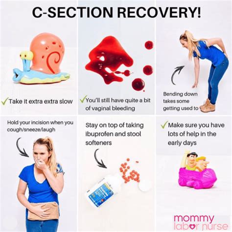 C Section Recovery Timeline A Week By Week Look At Recovery Forgotten Lattes Artofit