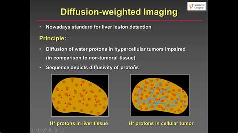 Liver Metastases What The Radiologist Needs To Know W Schima Youtube