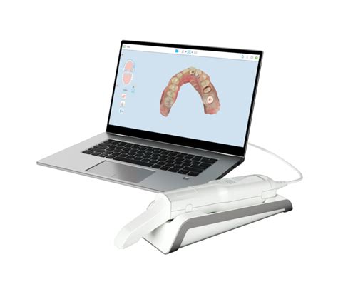 ITero Intraoral Scanners XYZ Dental
