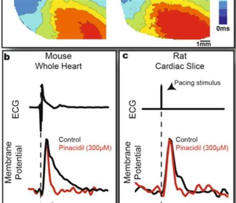 Open Source Solution Researchers 3d Print System For Optical Cardiography