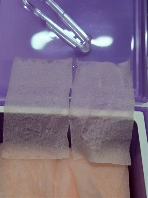 더쿠 바이오힐 보 프로바이오덤™ 콜라겐 리모델링 세럼 패드 And 세럼 실사용해봤는데 너무 좋다