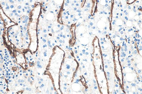 Cd31 Antibody 66065 2 Ig Proteintech