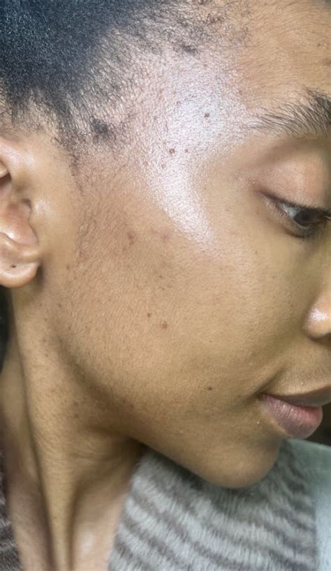 Pigmentation Fade Bundle Monday Muse