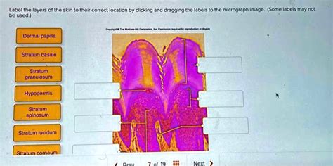 Label The Layers Of The Skin To Their Correct Location By Clicking And