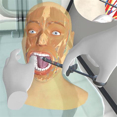 A Snapshot Of The Inferior Alveolar Nerve Block Ianb Procedure Being Download Scientific