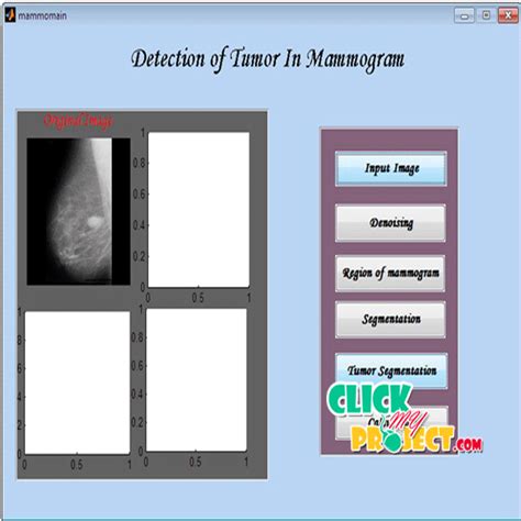 Detection Of Suspicious Lesions By Adaptive Thresholding Based On