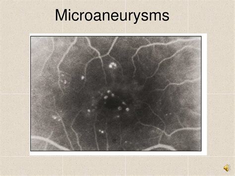 Ppt Fluorescein Angiography And Oct In Diabetic Retinopathy Powerpoint
