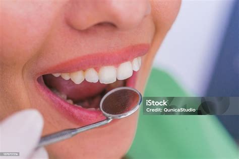 Closeup Pasien Wanita Dengan Mulut Terbuka Selama Pemeriksaan Oral Di Dokter Gigi Foto Stok