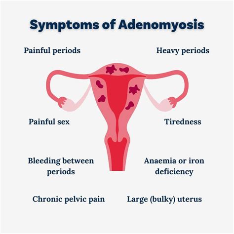Diagnosis Of Adenomyosis Adenomyosis How To Diagnose