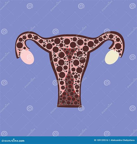 Malignant Neoplasm Metastases On Mobile App Onboarding Screens Ui Ux