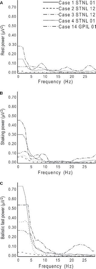 power spectra of stn lfp recorded through contralateral dbs electrodes