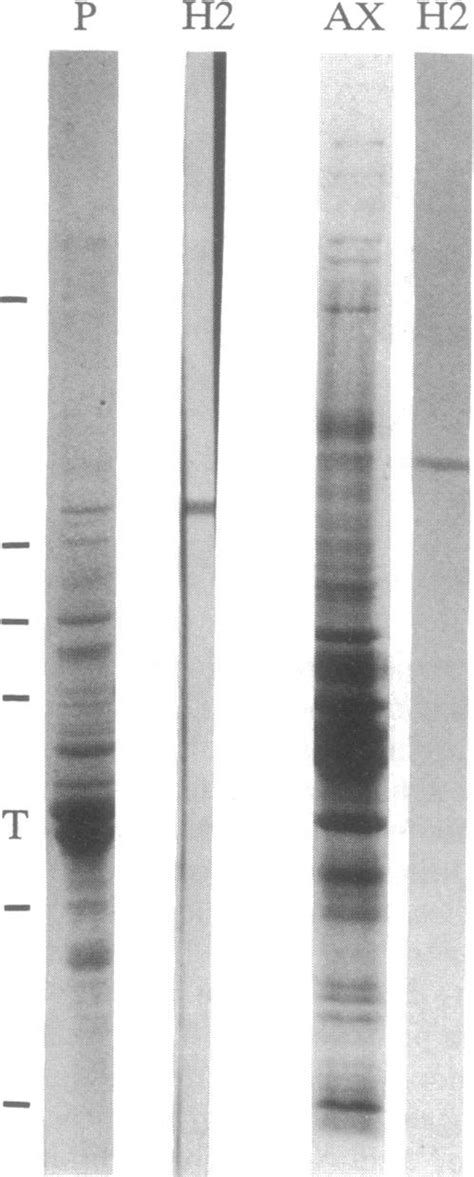 Recognition Of Squid Kinesin Heavy Chain By An Antibody Raised Against