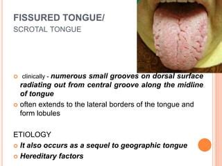 Developmental Disturbances Of Tongue Pptx