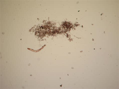 Phytophthora Cactorum Phytophthora Root Rot