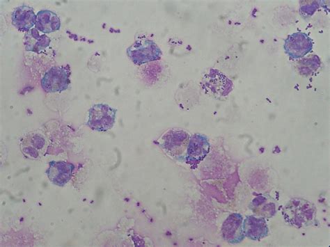 Cerebral Spinal Fluid Csf Urinalysis And Body Fluids