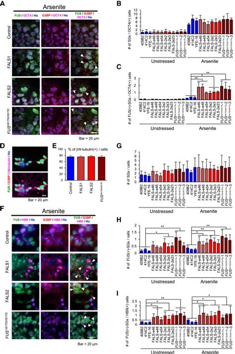 Fus Protein Localization Into Stress Granules Download Scientific Diagram