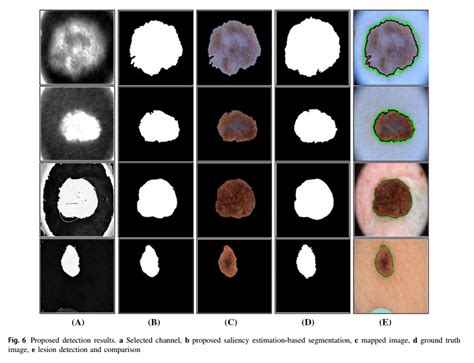 Skin Lesion Detection And Recognition In Matlab File Exchange MATLAB Central