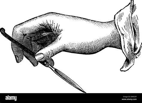 Position Of The Knife In The Single Incision From Within Outwards Made Against Us Without A